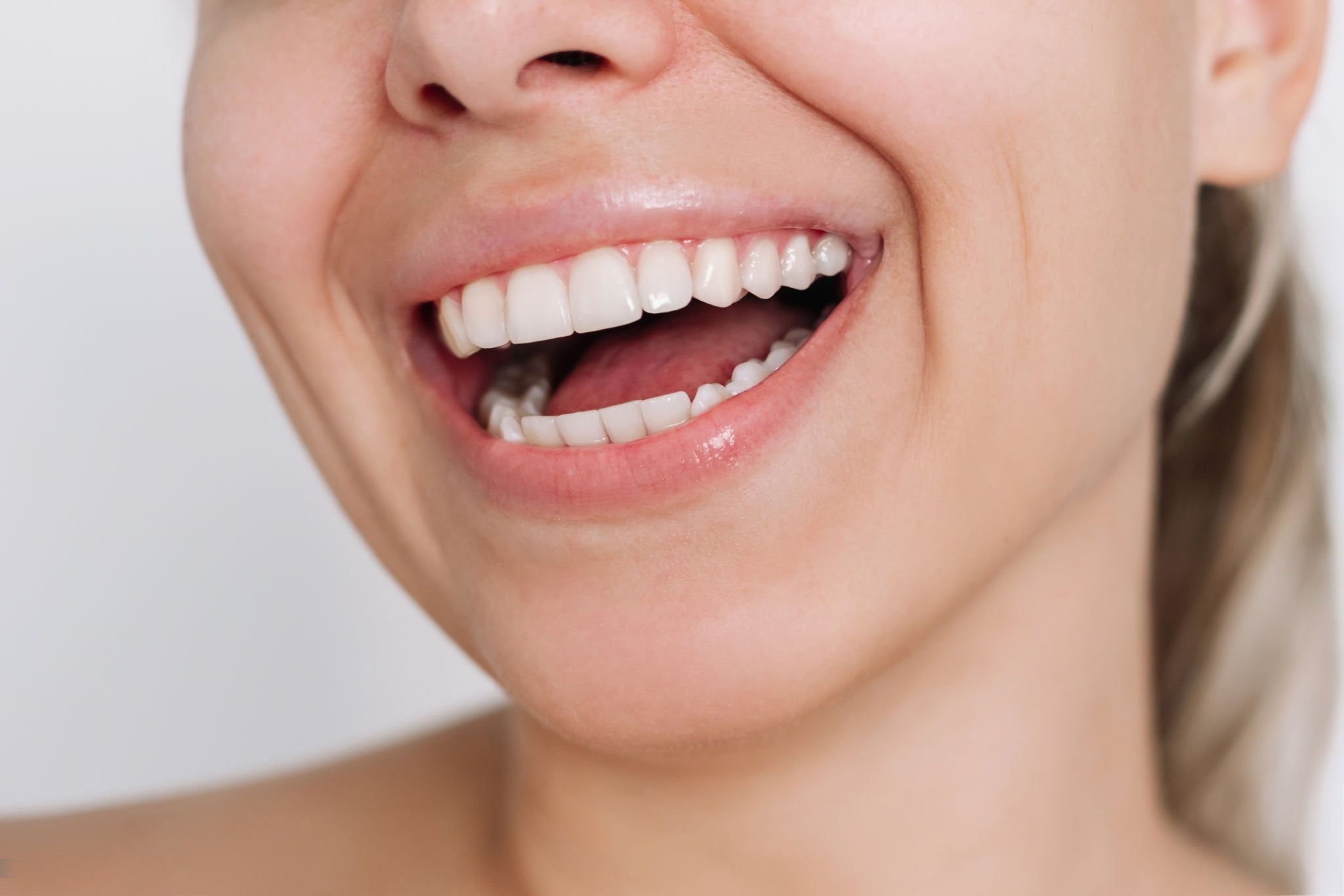 Spot the Perfect Smile: Celebrity Smiles vs. Everyday Charm – Smileie ...